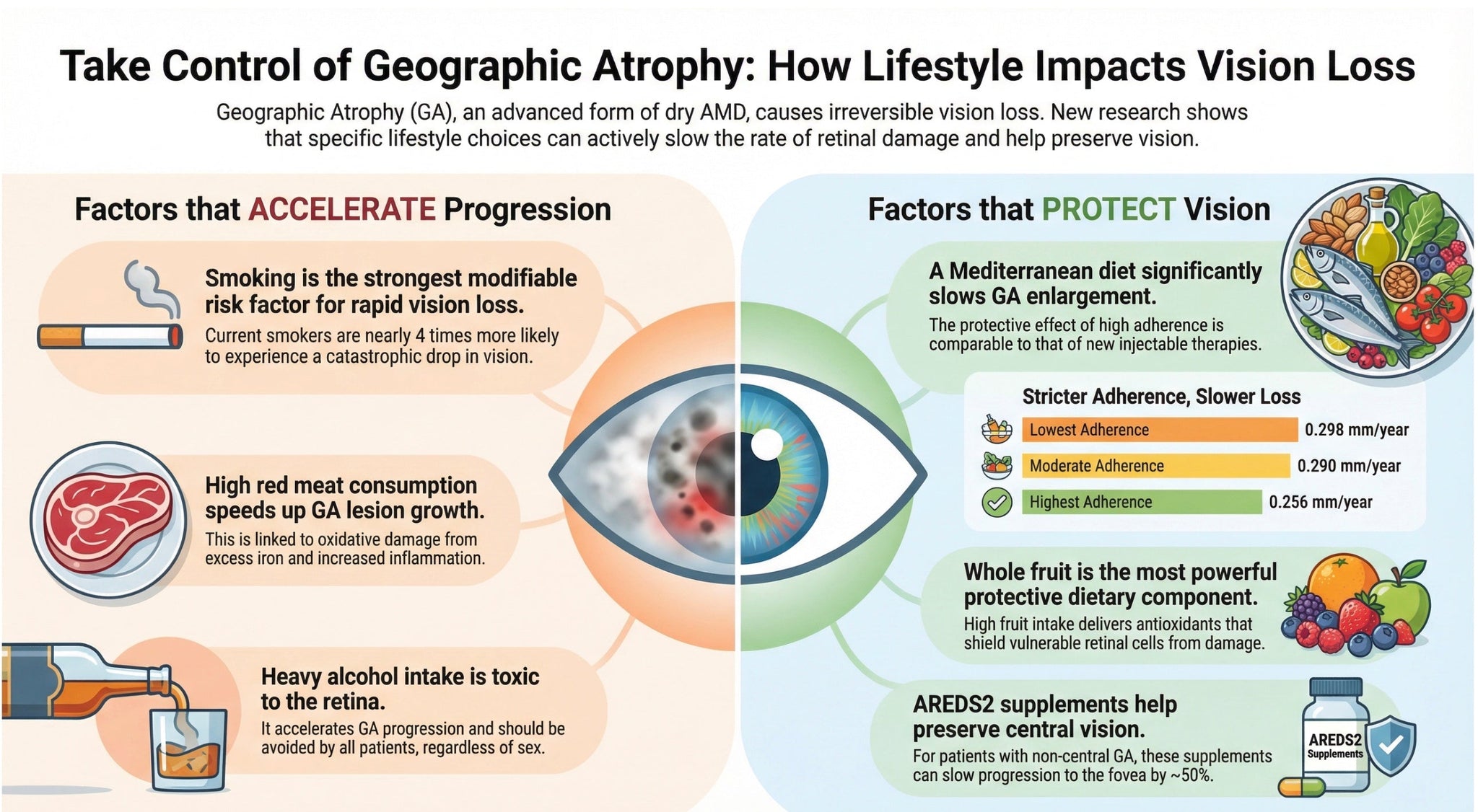 Lifestyle Factors and Geographic Atrophy (GA) Progression in Age-Relat